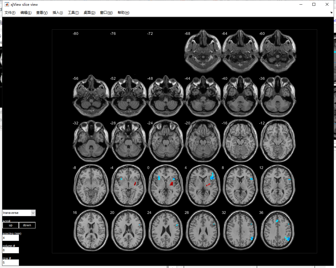 xjview脑区结果怎么看-CSDN博客