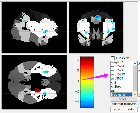 xjview脑区结果怎么看-CSDN博客