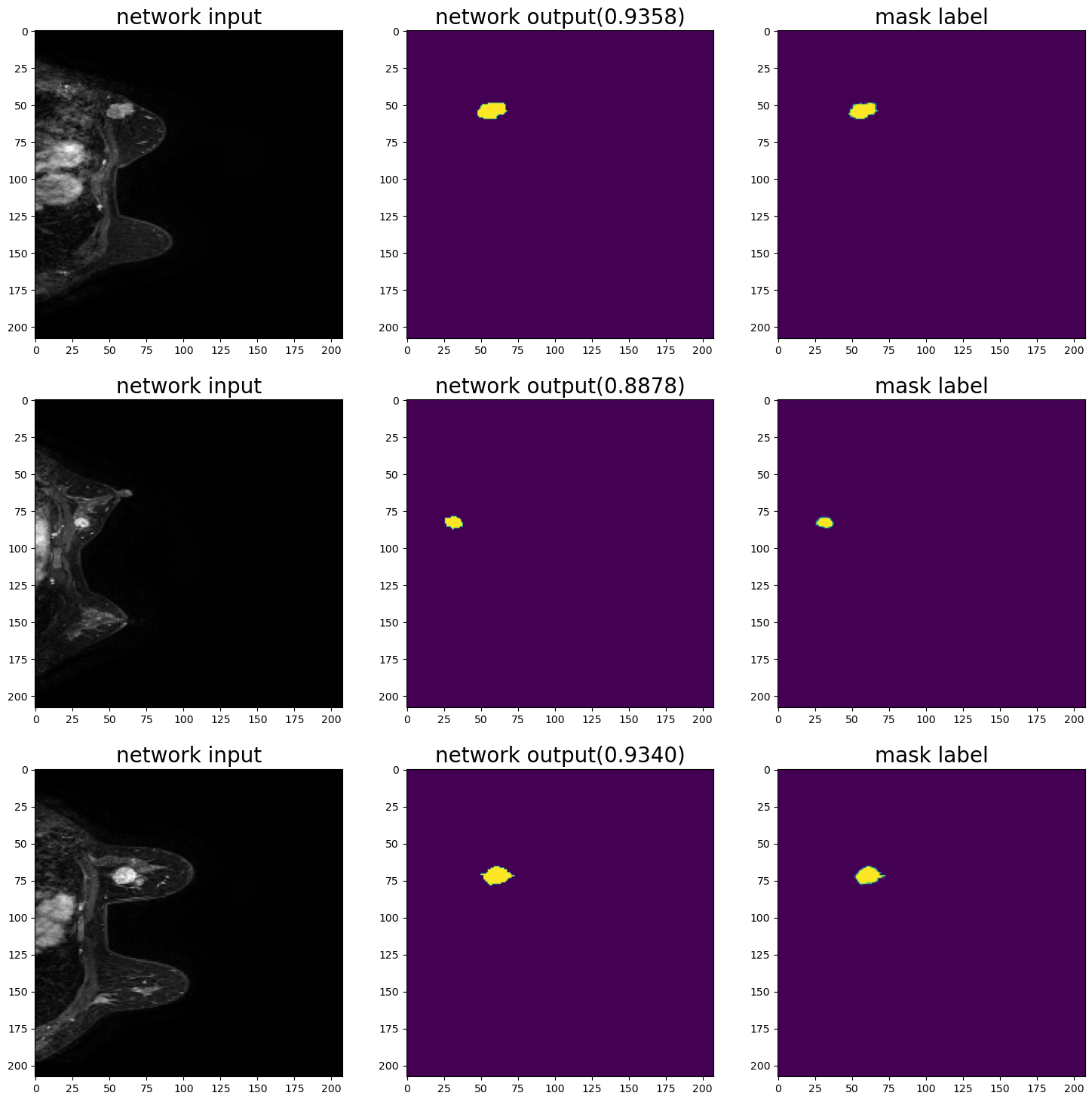 基于GPU版本的tensorflow2.0使用u_net对医疗图像进行分割_nii图像分割-CSDN博客