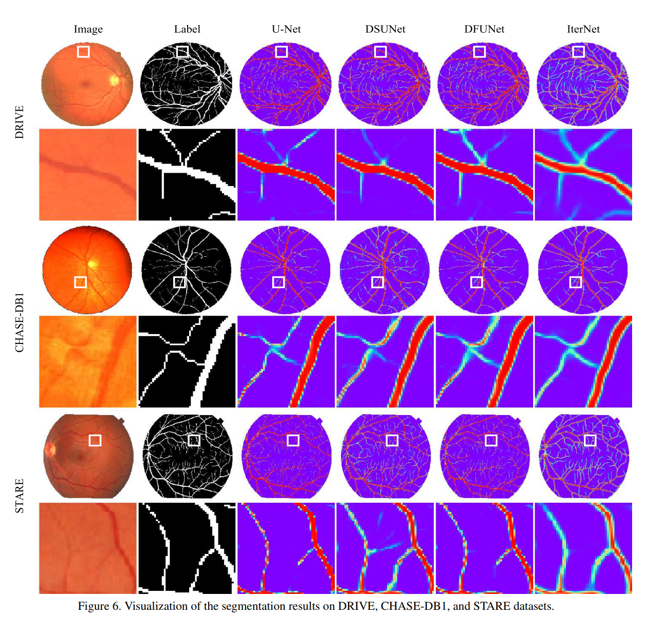 IterNet: Retinal Image Segmentation Utilizing Structural Redundancy in ...