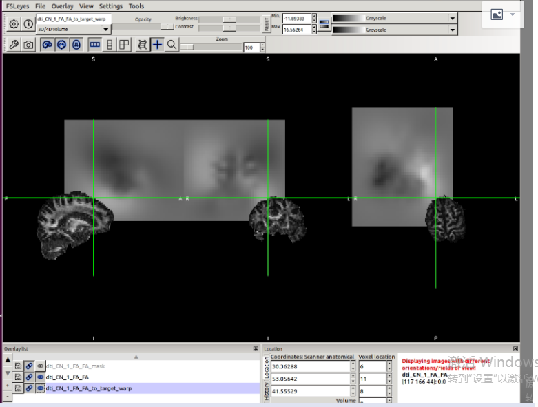 2021-04-06_用fsl做全脑fa值差异-CSDN博客