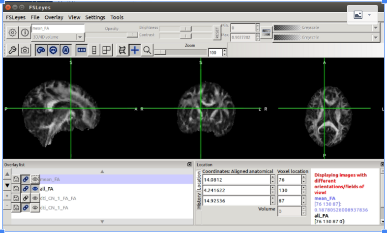 2021-04-06_用fsl做全脑fa值差异-CSDN博客