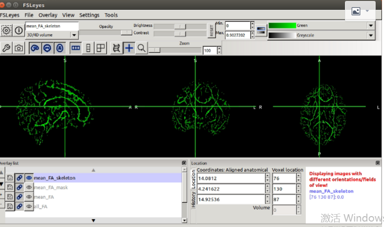 2021-04-06_用fsl做全脑fa值差异-CSDN博客