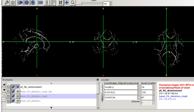 2021-04-06_用fsl做全脑fa值差异-CSDN博客