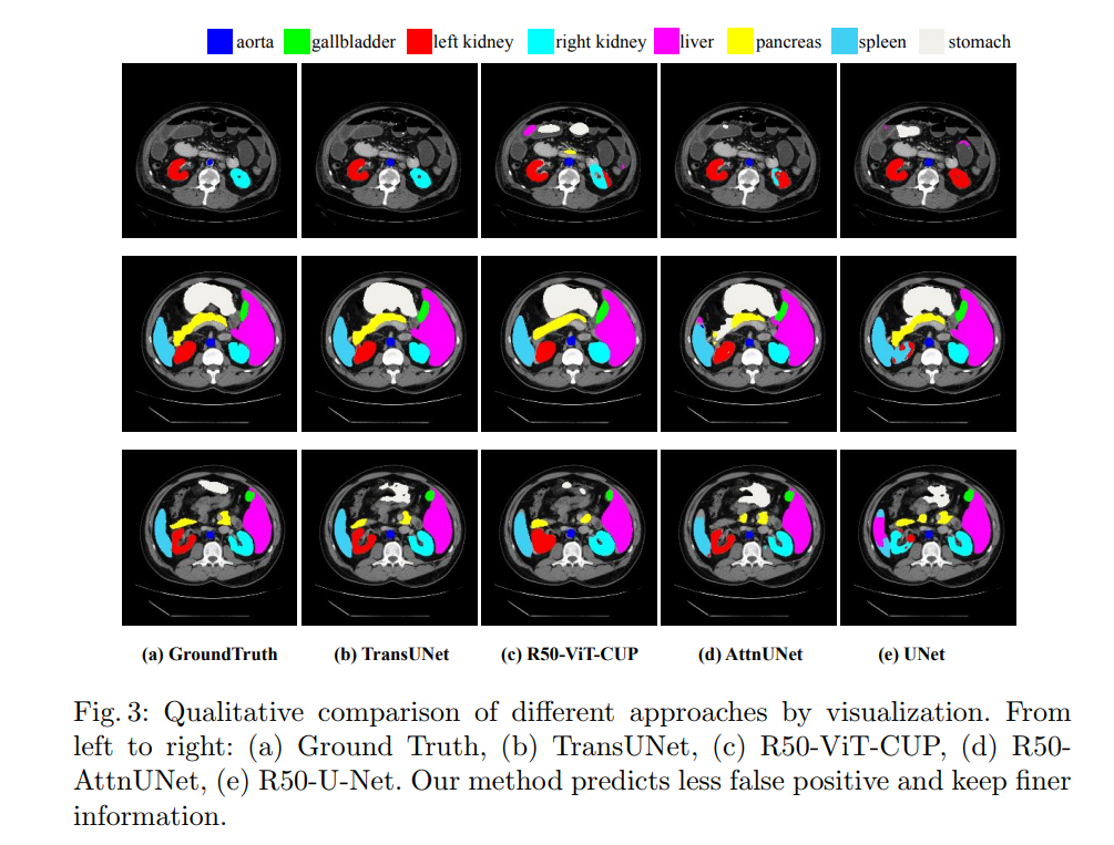 TransUNet: Transformers Make Strong Encoders for Medical Image ...