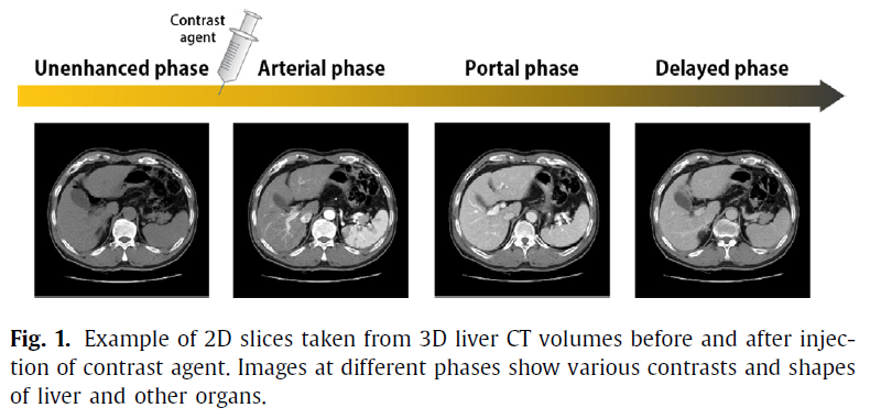 Deep Learning Based Registration文章阅读(七)《CycleMorph: Cycle consistent unsupervised deformable ...