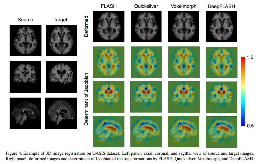配准文献DeepFLASH: An Efficient Network for Learning-based Medical Image Registration_frequency ...