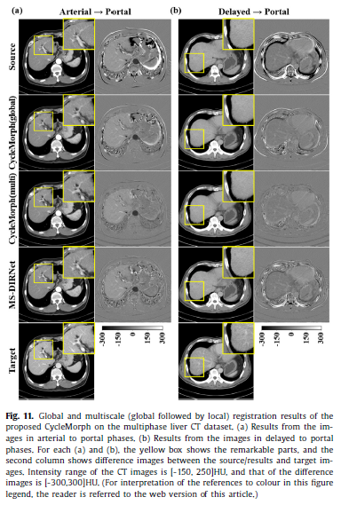 Deep Learning Based Registration文章阅读(七)《CycleMorph: Cycle consistent unsupervised deformable ...