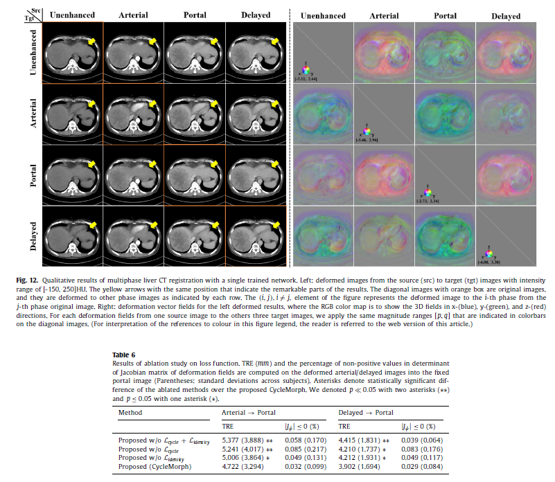 Deep Learning Based Registration文章阅读(七)《CycleMorph: Cycle consistent unsupervised deformable ...