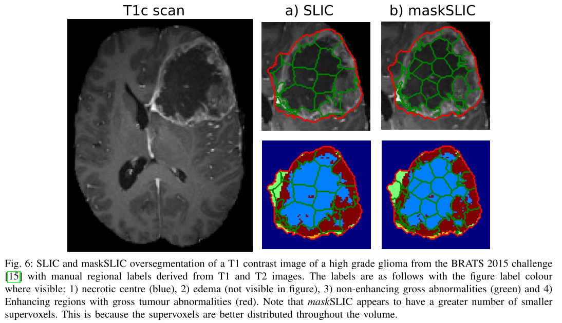 超像素 Maskslic Regional Superpixel Generation Csdn博客 
