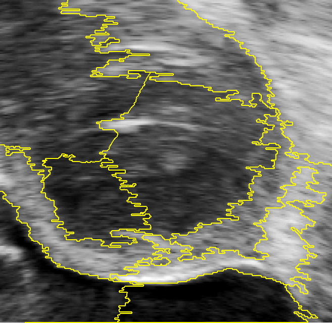 SLIC超像素分割并保存分割得到的超像素块，python代码_python中的slic分割-CSDN博客