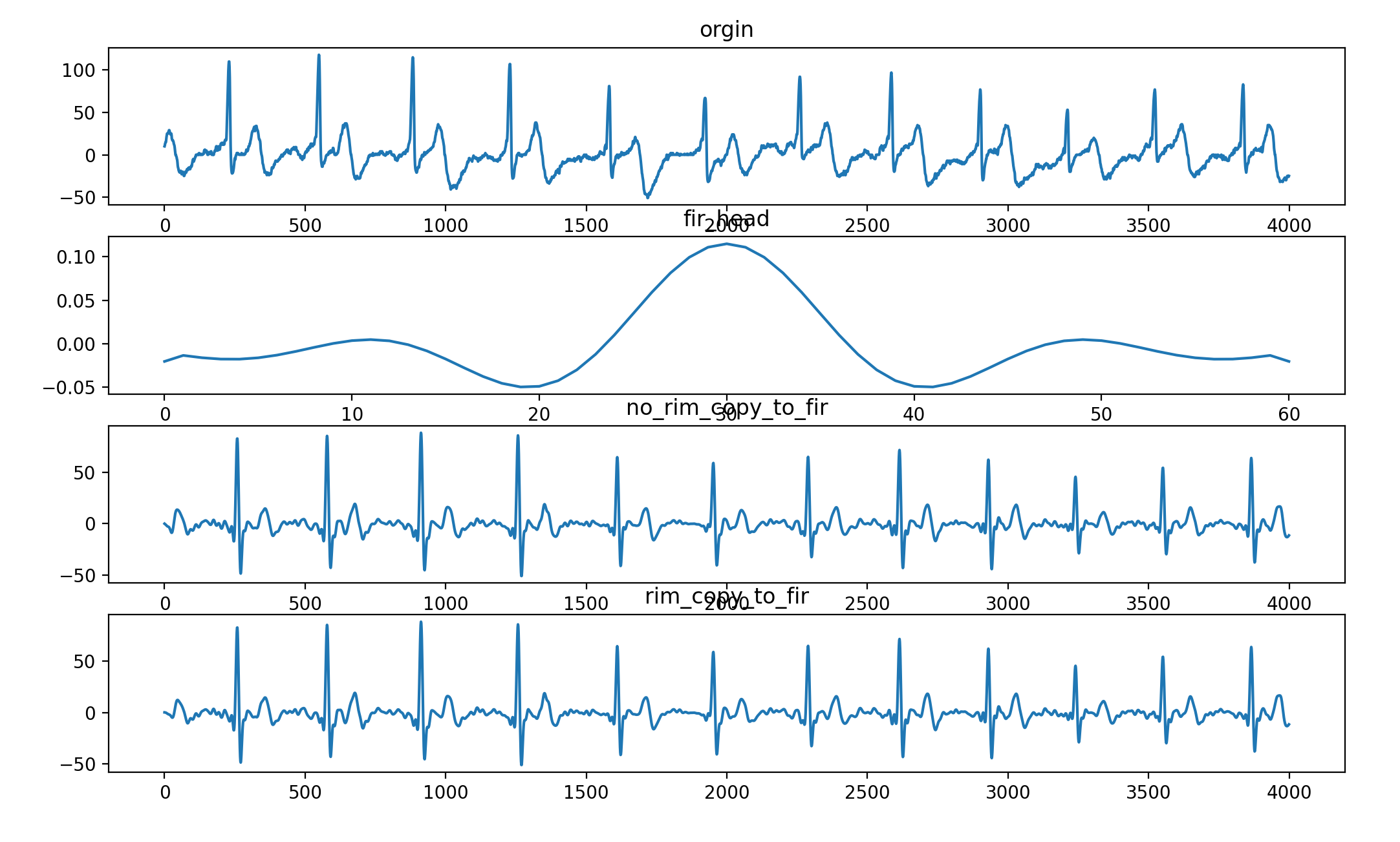 ECG心电信号处理-FIR_fir处理ecg信号-CSDN博客