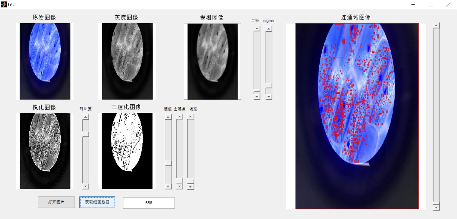 【细胞分割】基于matlab Gui生物细胞计数【含matlab源码 758期】细胞计数matlab直方图 Csdn博客 