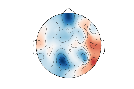 mne绘制脑地形图_mne脑地形图_LiDLMU的博客-CSDN博客