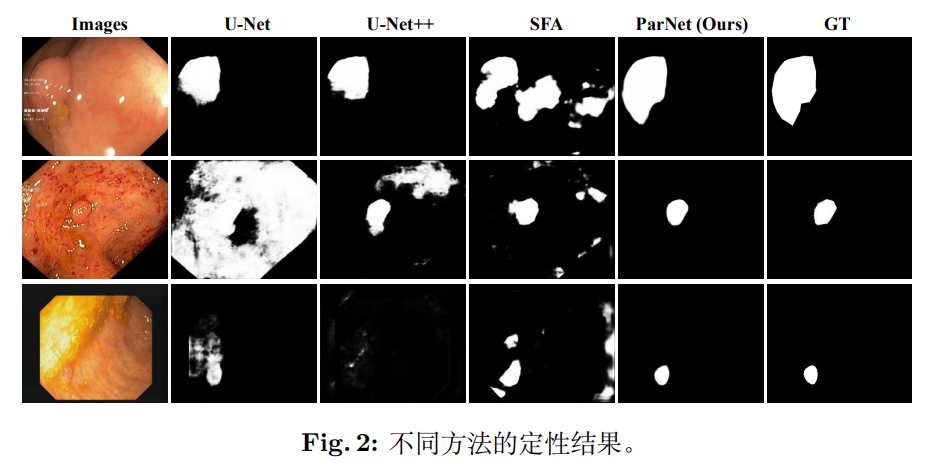 PraNet: Parallel Reverse Attention Network for Polyp Segmentation阅读笔记_深度学习rab模块-CSDN博客