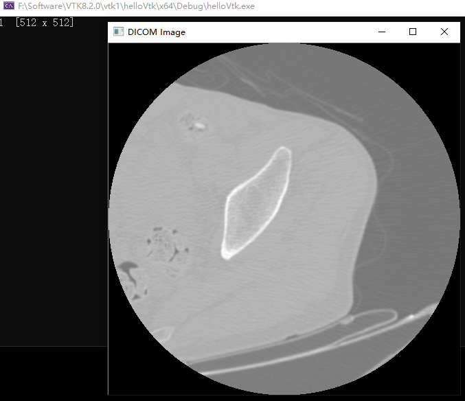 Opencv系列1_opencv对单张DCM文件的读取并显示_dcm创口识别-CSDN博客