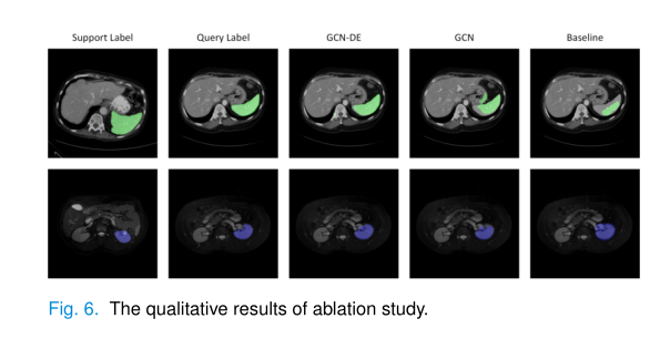 [医学小样本分割]Few-shot Medical Image Segmentation using a Global Correlation Network with ...