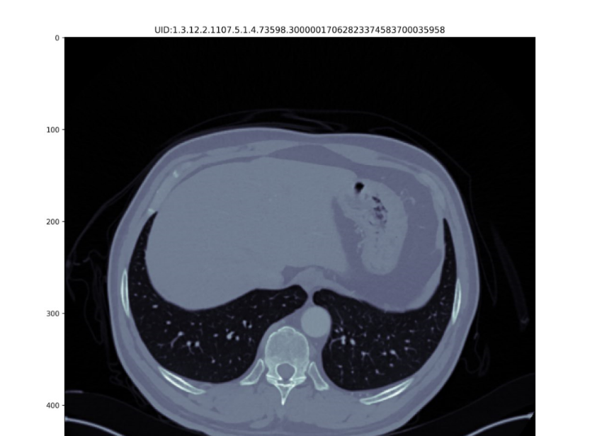 pydicom图像数据的保存_pydicom保存dcm-CSDN博客