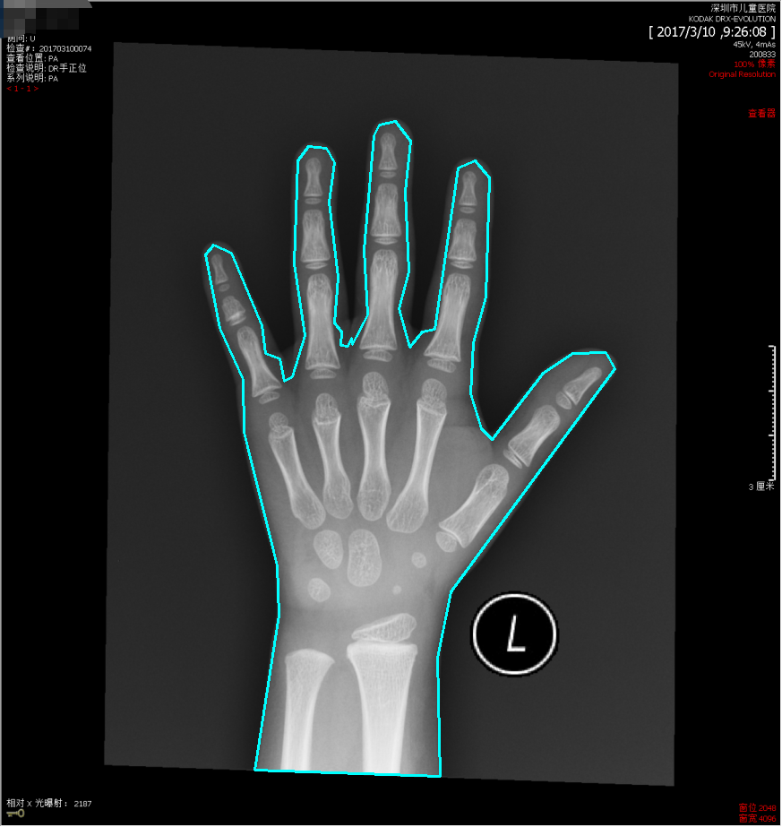 python-OpenCV-多边形拟合_python approxpolydp-CSDN博客