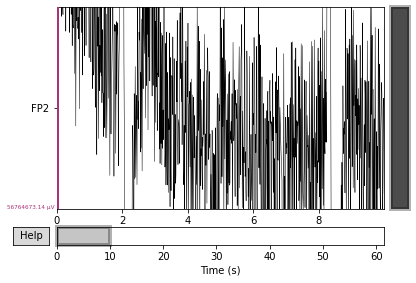 脑电数据预处理_如何对脑电图数据进行预处理python-CSDN博客