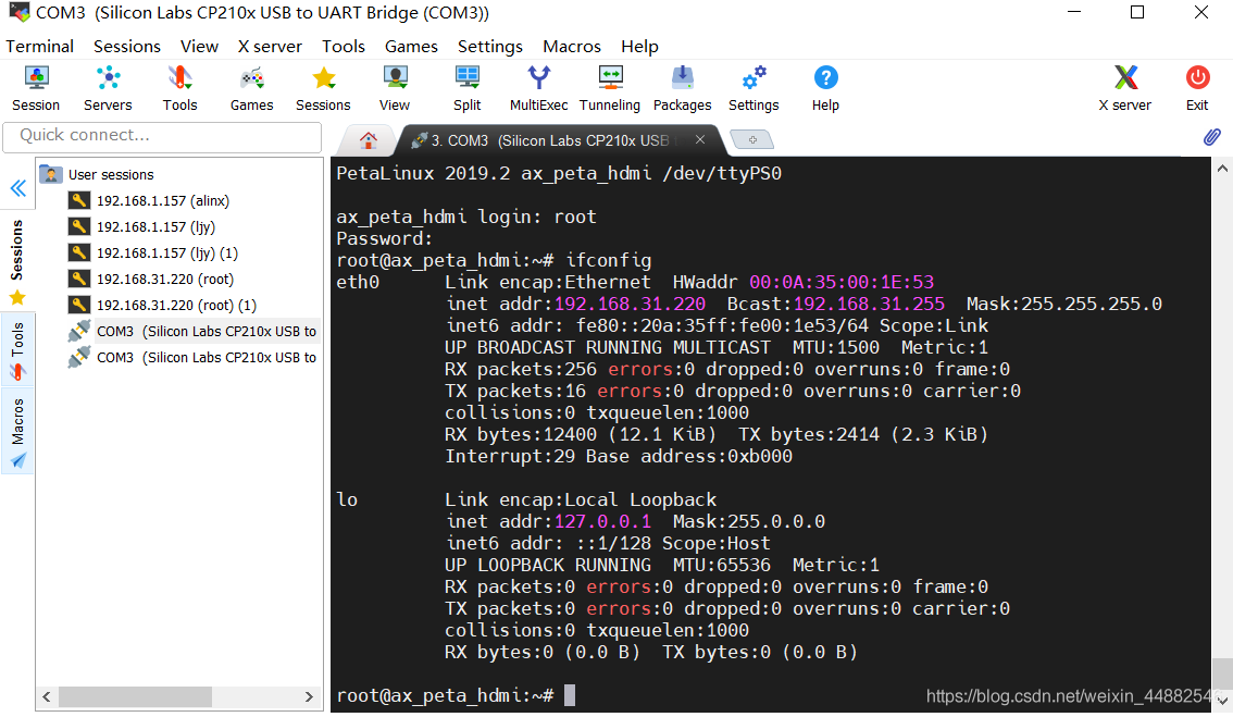 ZYNQ平台的HDMI驱动测试_zynq linux hdmi-CSDN博客