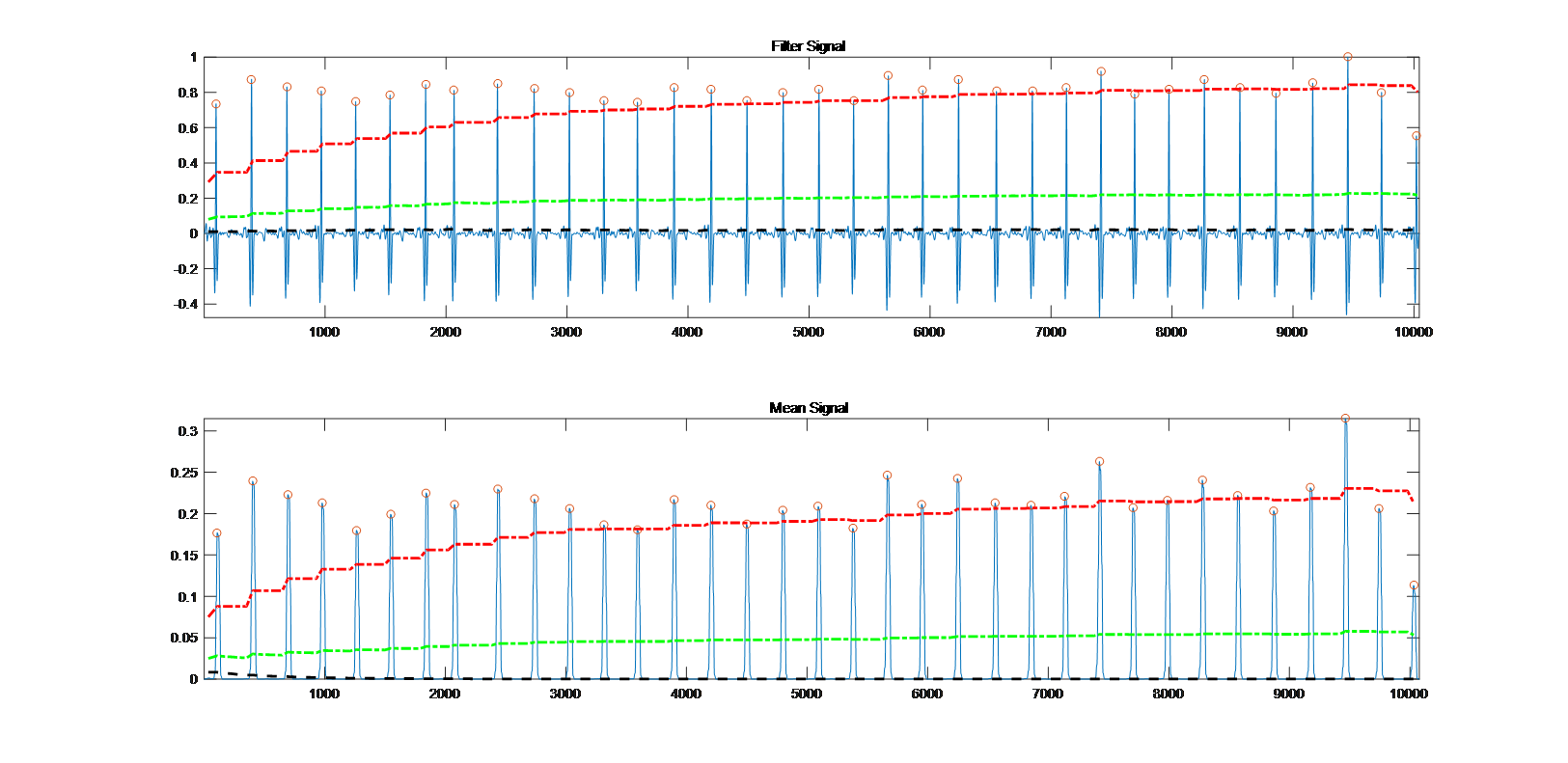 Ecg信号QRS波峰检测：A Real-Time QRS Detection Algorithm (Pan-Tompkins法)-CSDN博客