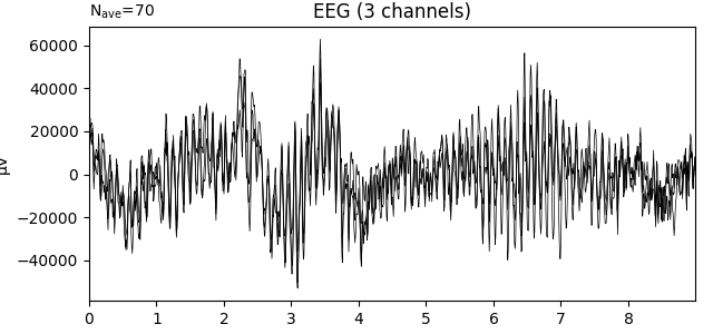 python中利用mne获取.mat文件中的脑电数据，画出epochs数据图像。_mne读取mat文件_北荒的你的博客-CSDN博客