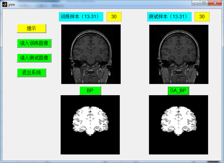 基于GA优化的BP网络算法分析与MATLAB实现【matlab优化算法三】_matalab bp-ga算法-CSDN博客