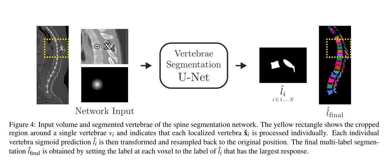 论文阅读：Coarse to Fine Vertebrae Localization and Segmentation with SpatialConfiguration-Net and U ...