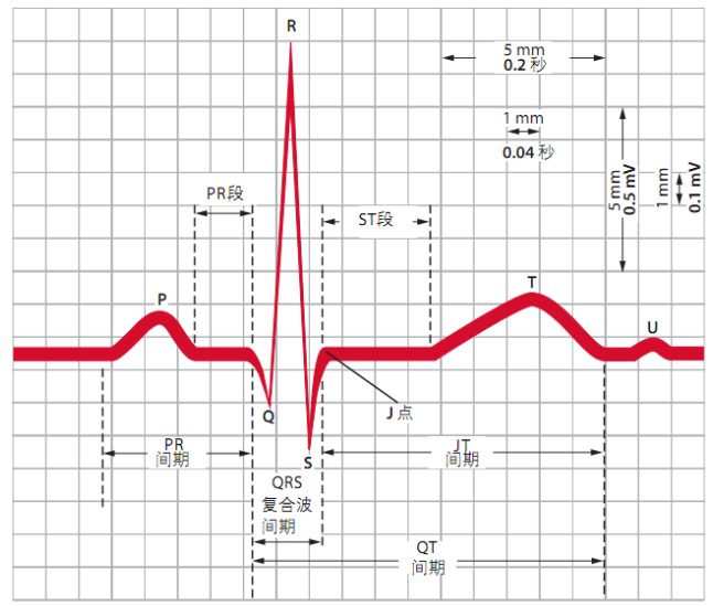 Deep Learning × ECG (1) ：关于心律失常ECG的基础常识_由心律失常国际竞赛(cinc challenge)提供的多个心电数据库。-CSDN博客