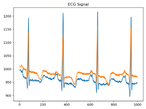Deep Learning × ECG (2) ：利用WFDB包读取心律失常ECG数据-CSDN博客