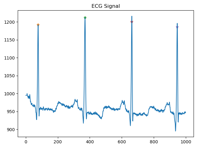 Deep Learning × ECG (2) ：利用WFDB包读取心律失常ECG数据-CSDN博客
