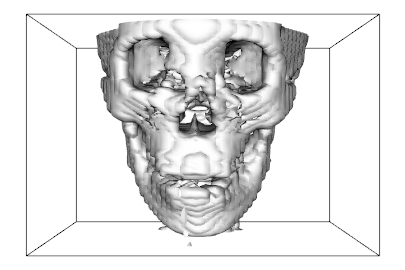 VTK笔记-CT图像获取皮肤等值面-vtkContourFilter类的使用-CSDN博客