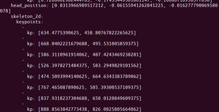 双目立体视觉（4）- ZED2双目视觉开发理论与实践 with examples 0.1 object detection_zed 2-CSDN博客