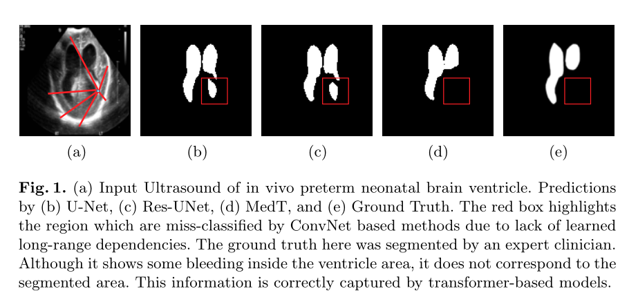 Medical Transformer: Gated Axial-Attention for Medical Image Segmentation-CSDN博客