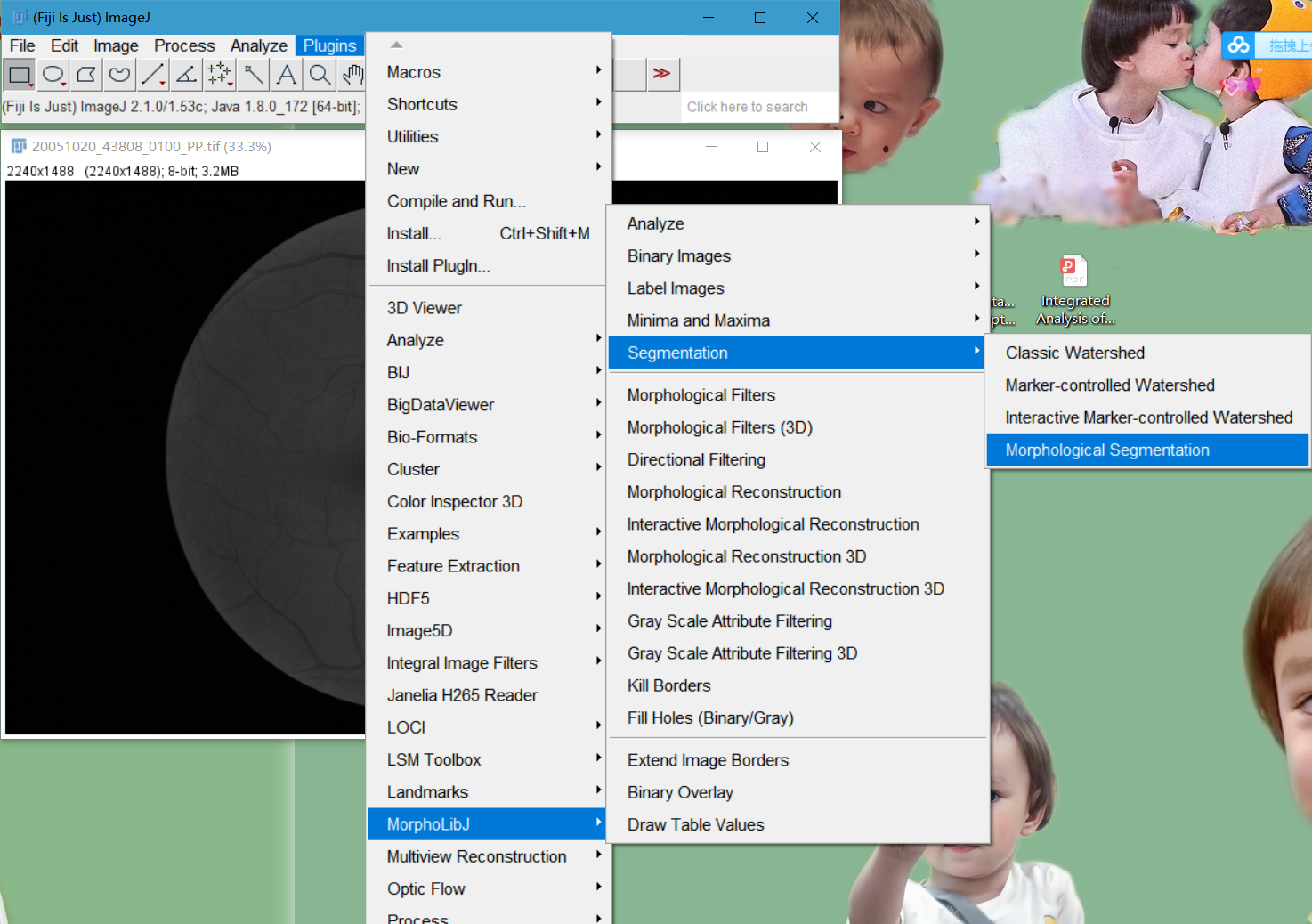 Fuji-ImageJ分割中央凹无血管区_morpholibj插件下载-CSDN博客