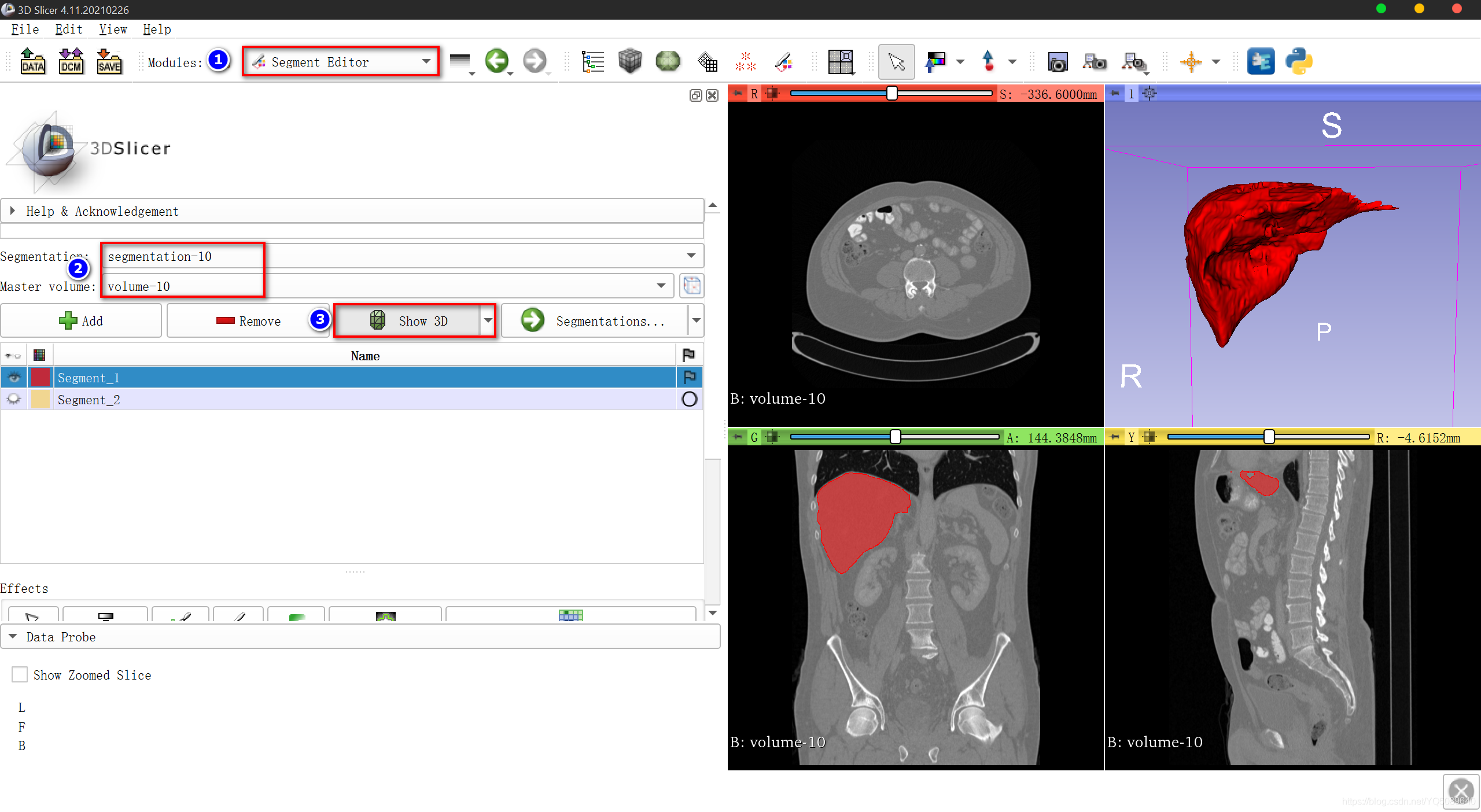 【深度学习笔记】3d Slicer三维可视化3dslicer不显示3d图 Csdn博客
