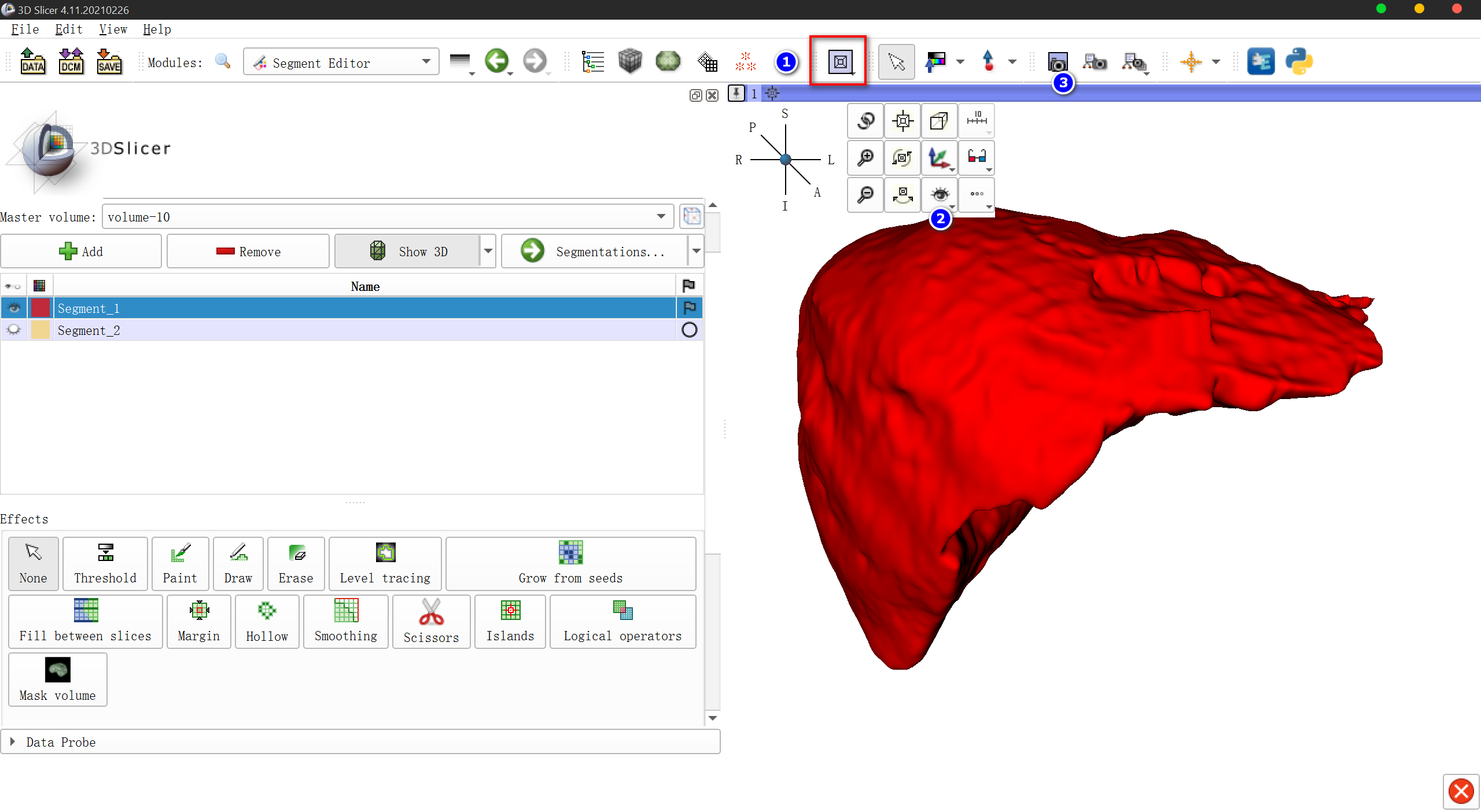【深度学习笔记】3D Slicer三维可视化_3dslicer不显示3d图-CSDN博客