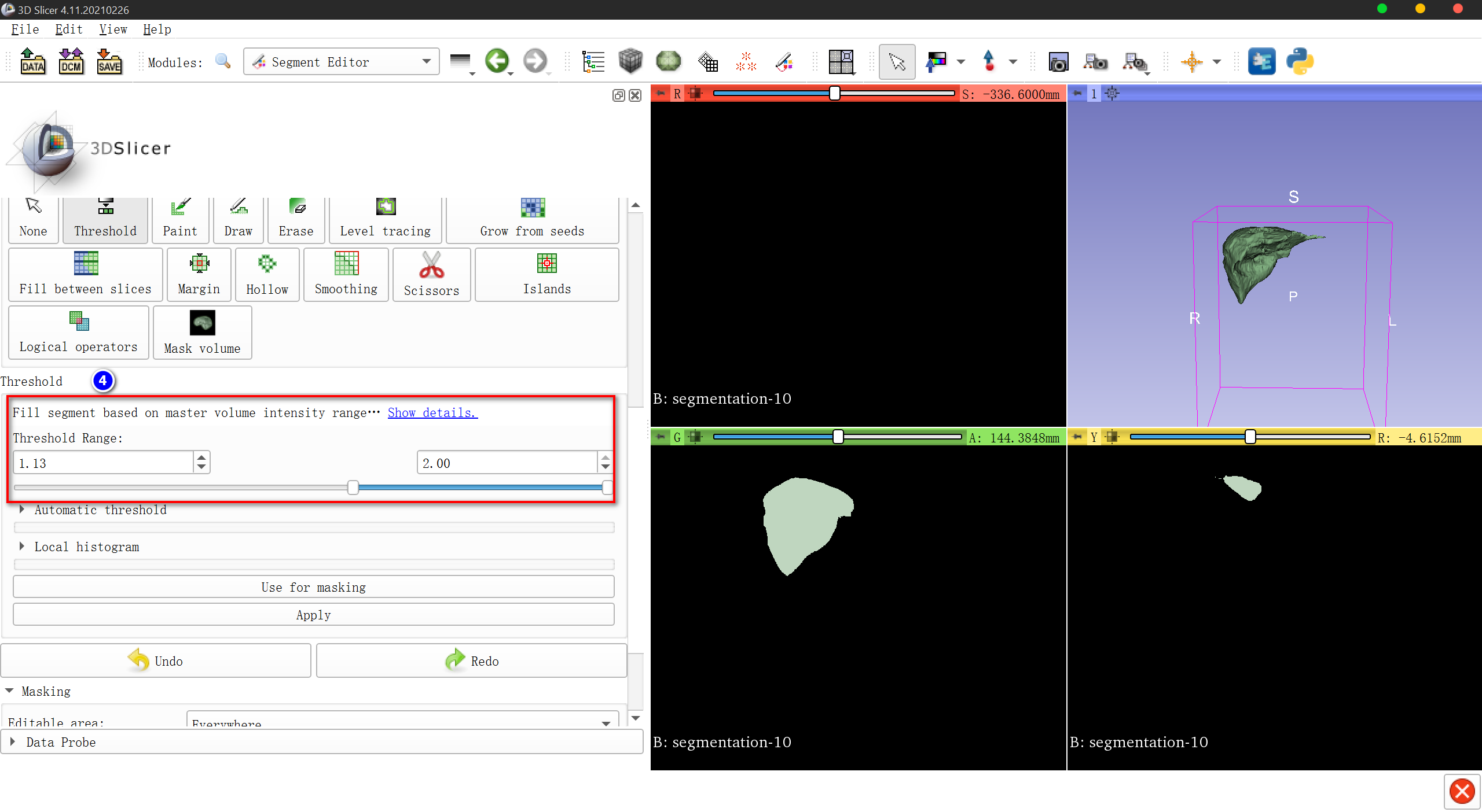 【深度学习笔记】3d Slicer三维可视化3d Slicer和深度学习nirreb的博客 Csdn博客 