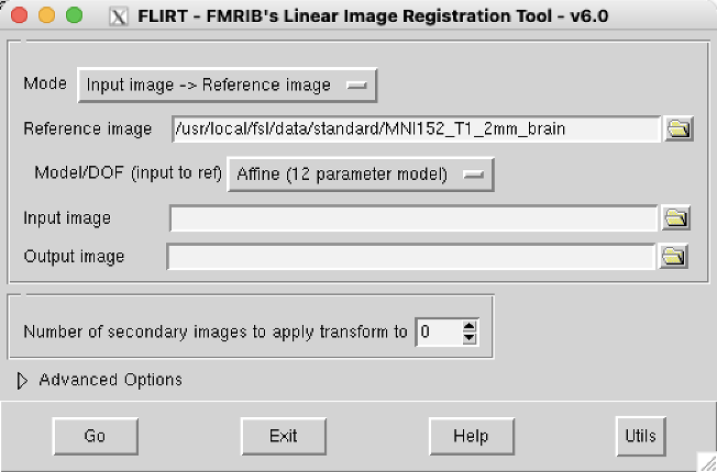 fsl线性配准实践+核磁共振影像数据处理_fsl配准4d数据-CSDN博客