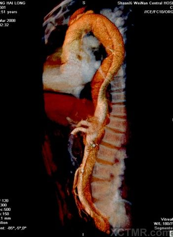 医学知识-VR（容积重建）_vr医学影像上是什么意思-CSDN博客
