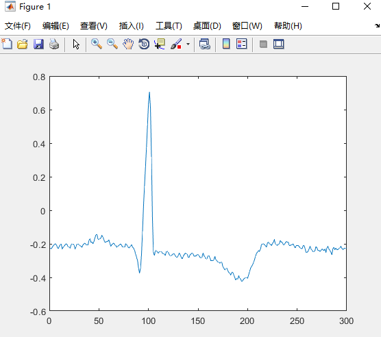 WFDB View ECG Signals - Programmer Sought