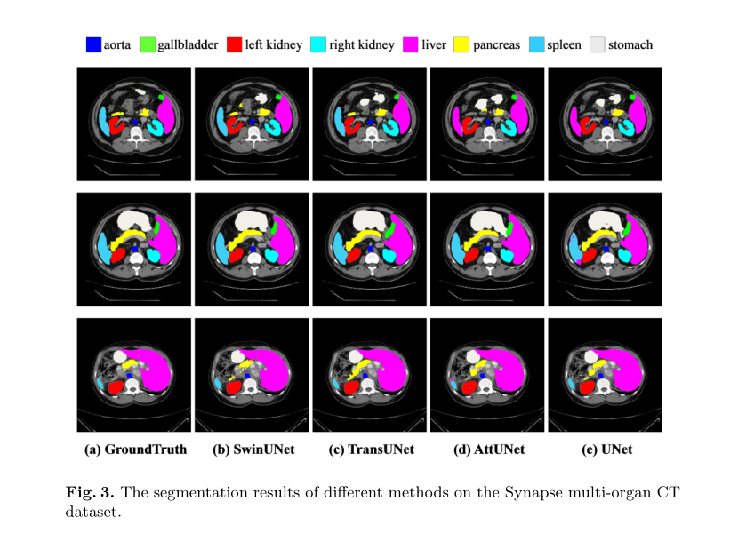 Swin-Unet论文研读_synapse multi-organ segmentation dataset-CSDN博客