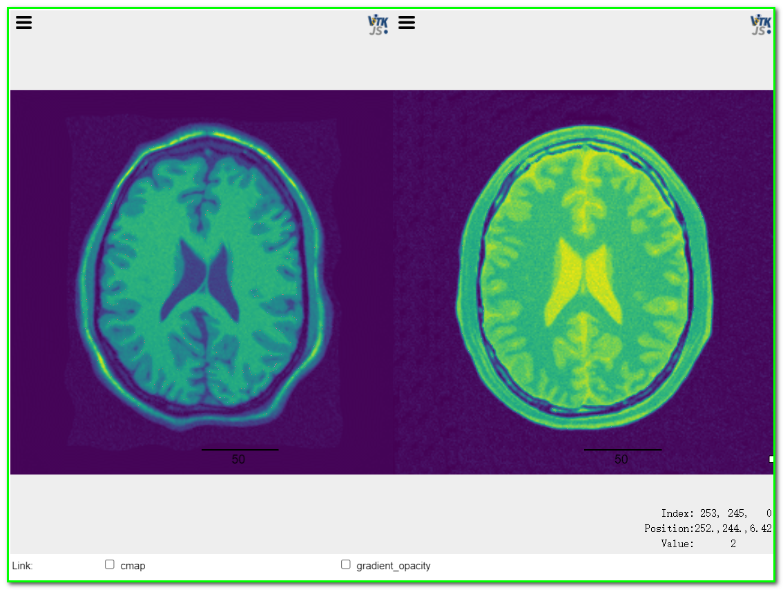【ITKElastix 教程】01配准基本介绍_elastix的平均配准时间-CSDN博客