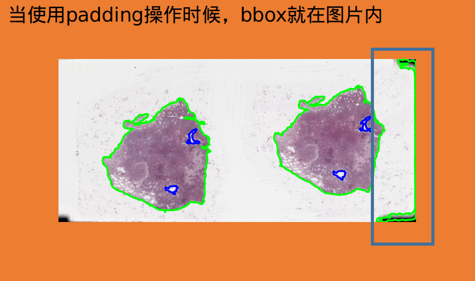（CNS复现）CLAM——Chapter_02_clam复现-CSDN博客