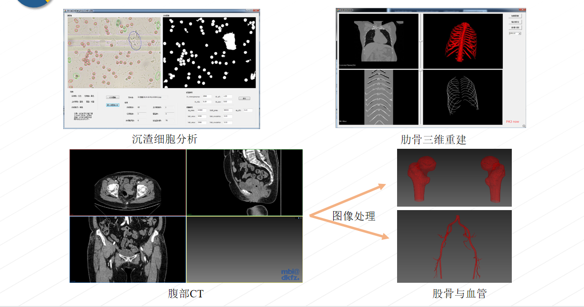 Opencv图像处理技术之数字图像处理基础wyolo的博客 Csdn博客 