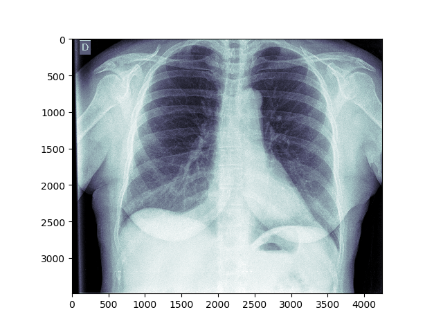 python-读取dcm文件-2021.5.24_python打开dcm文件并显示头文件-CSDN博客