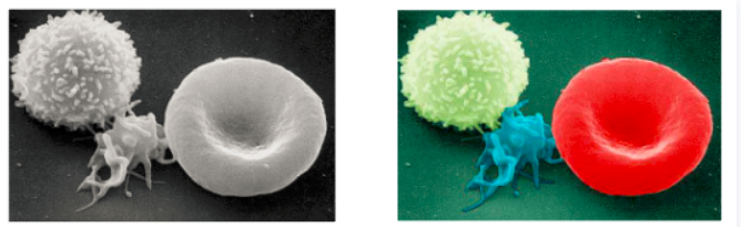 SEM: 科研图片处理_sem图片怎么处理-CSDN博客