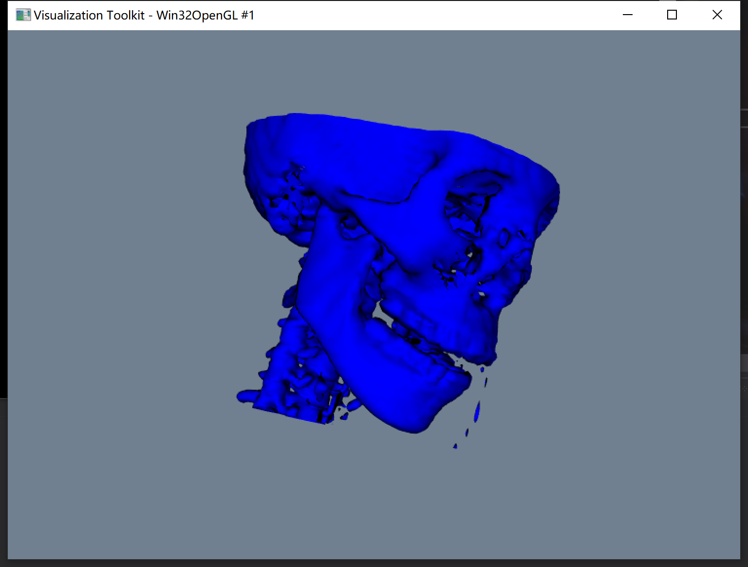 Marching Cubes算法在医学三维重建中的应用_医学3d算法库-CSDN博客