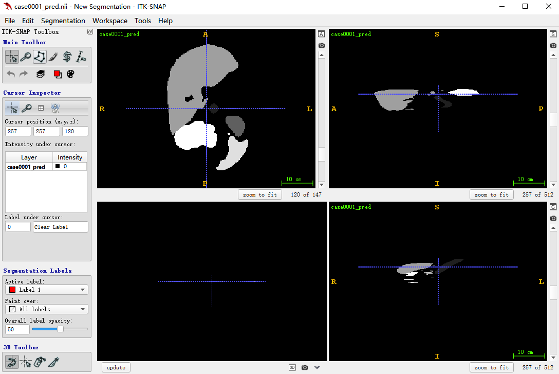 TransUNet阅读笔记与训练尝试_.npy.h5-CSDN博客